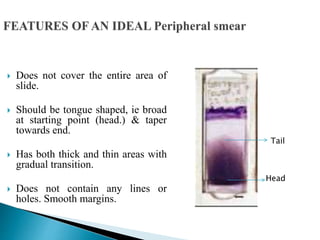 Peripheral Smear technique and reporting | PPTX