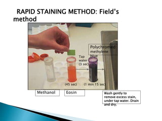 Peripheral Smear technique and reporting | PPTX