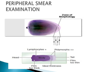 Peripheral Smear technique and reporting | PPTX