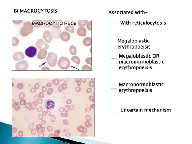 Peripheral Smear technique and reporting | PPTX | Blood Disorders ...