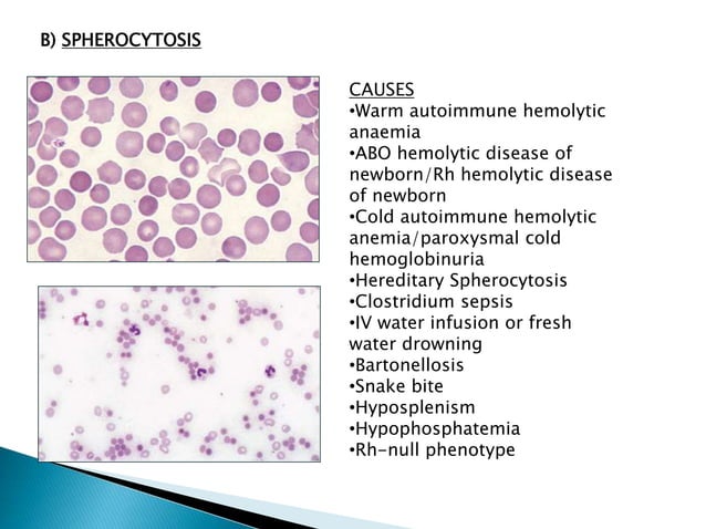 Peripheral Smear technique and reporting | PPTX | Blood Disorders ...