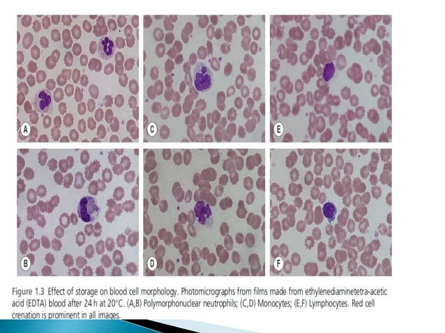 Peripheral Smear technique and reporting | PPTX | Blood Disorders ...