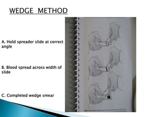 Peripheral Smear technique and reporting | PPTX