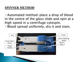 Peripheral Smear technique and reporting | PPTX