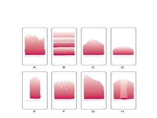 Peripheral smear including staining and DLC | PPTX