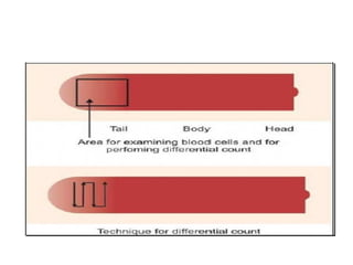 Peripheral smear including staining and DLC | PPTX