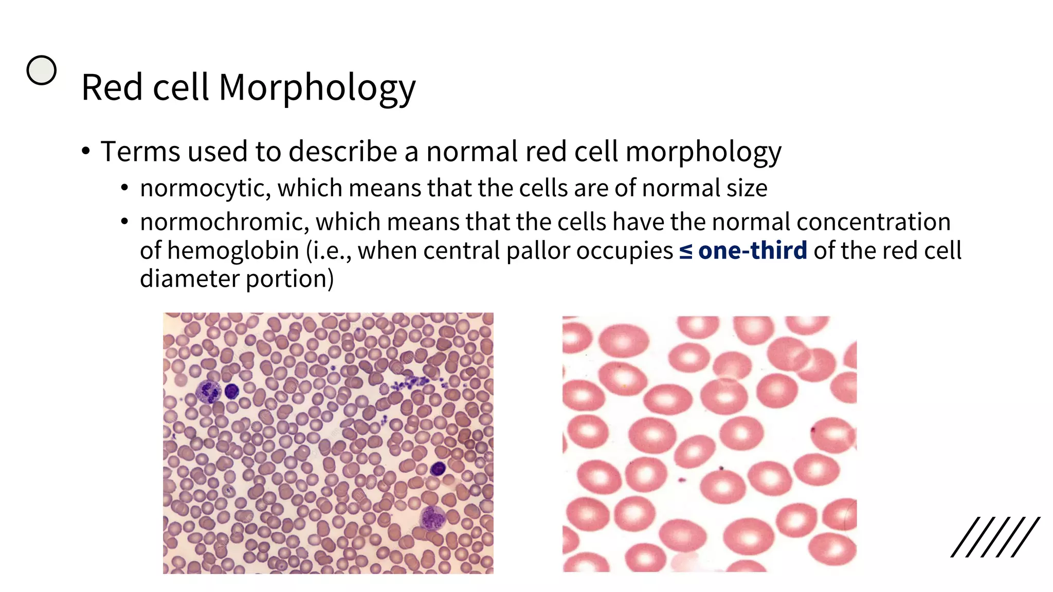 Peripheral smear staining and morphology | PDF