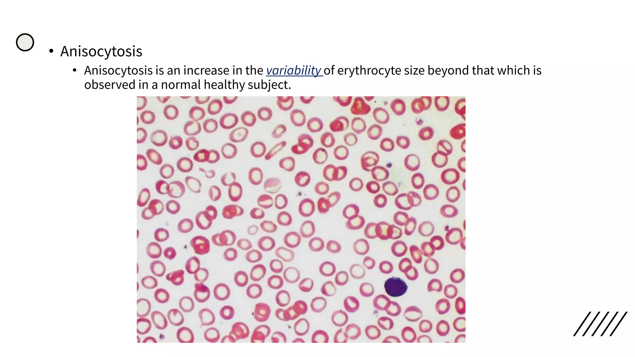 Peripheral smear staining and morphology | PDF