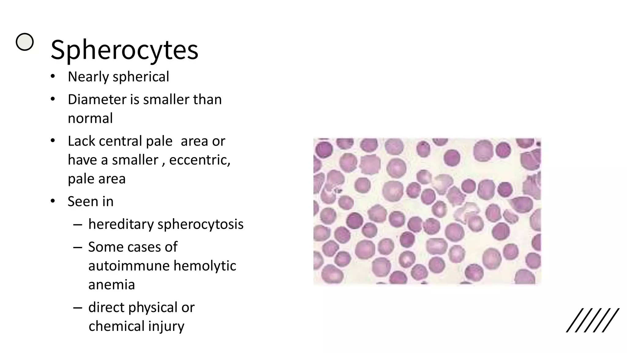 Peripheral smear staining and morphology | PDF
