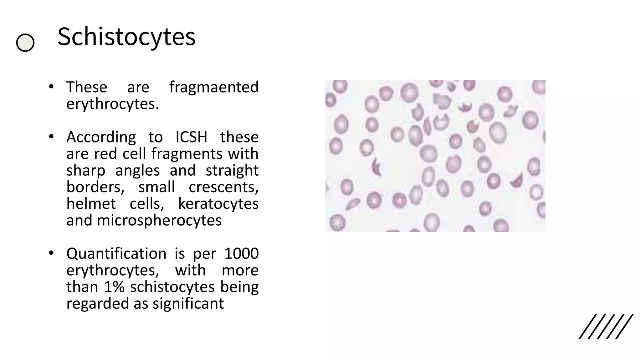 Peripheral smear staining and morphology | PDF