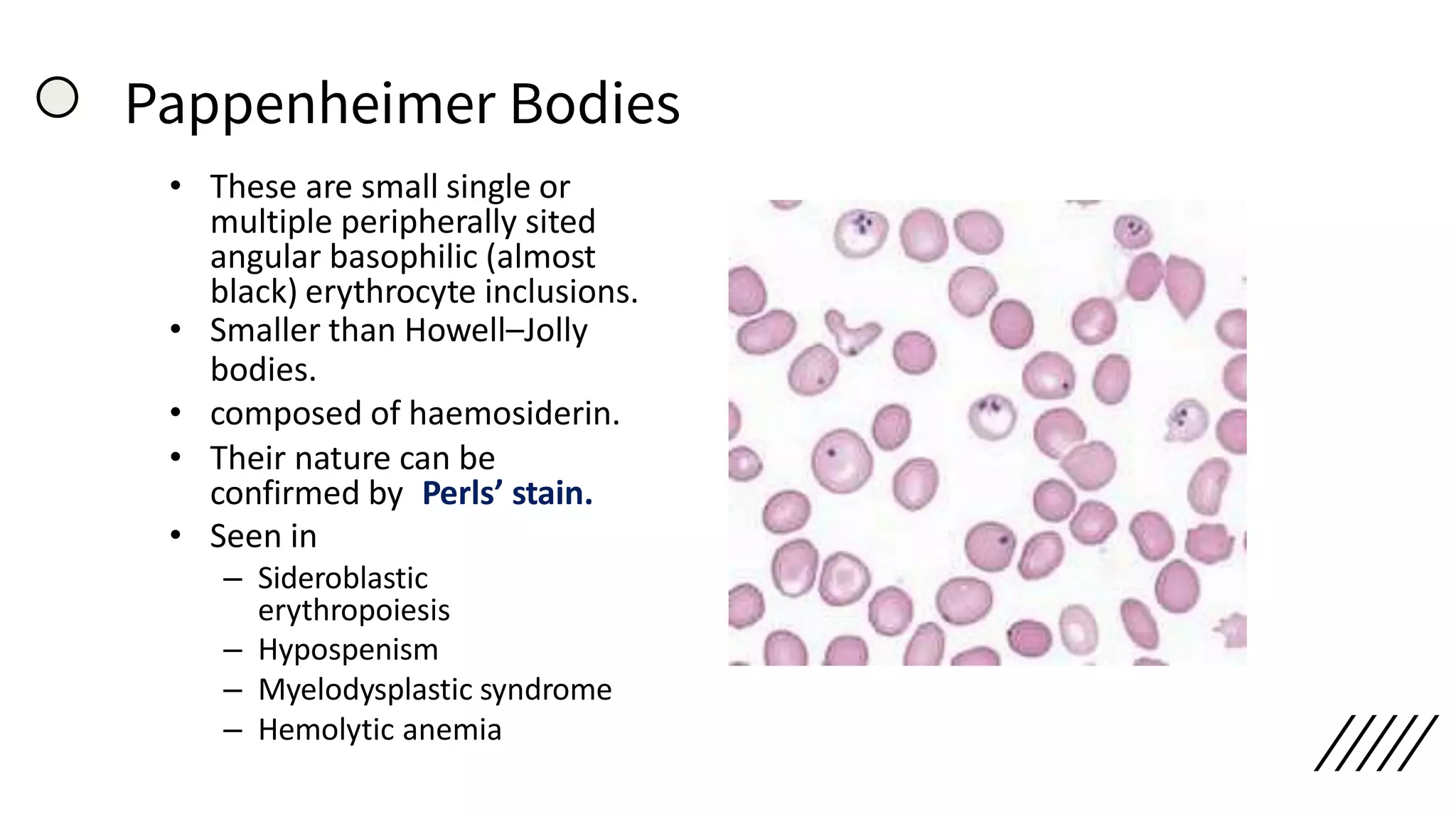 Peripheral smear staining and morphology | PDF