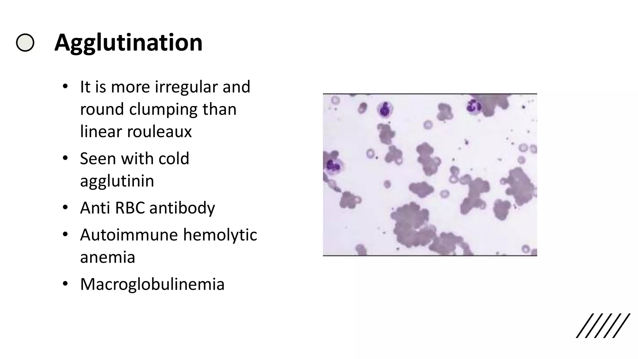 Peripheral smear staining and morphology | PDF