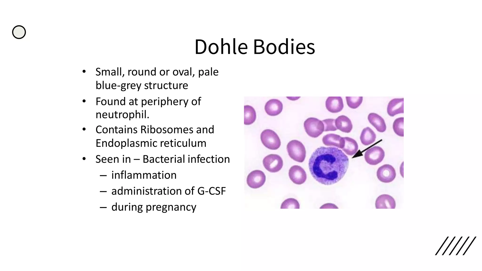 Peripheral smear staining and morphology | PDF