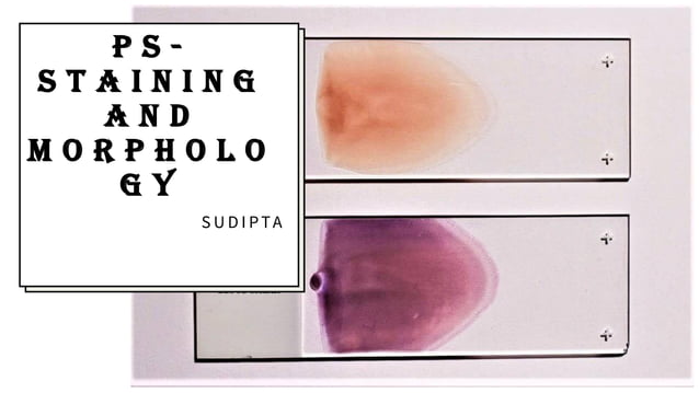 Peripheral smear staining and morphology | PDF | Blood Disorders ...