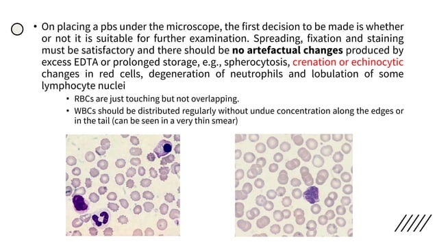 Peripheral smear staining and morphology | PDF | Blood Disorders ...