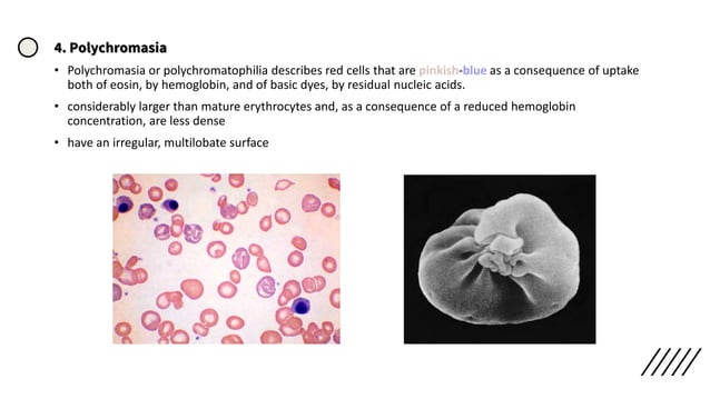 Peripheral smear staining and morphology | PDF | Blood Disorders ...
