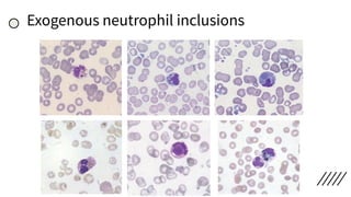 Peripheral smear staining and morphology | PDF