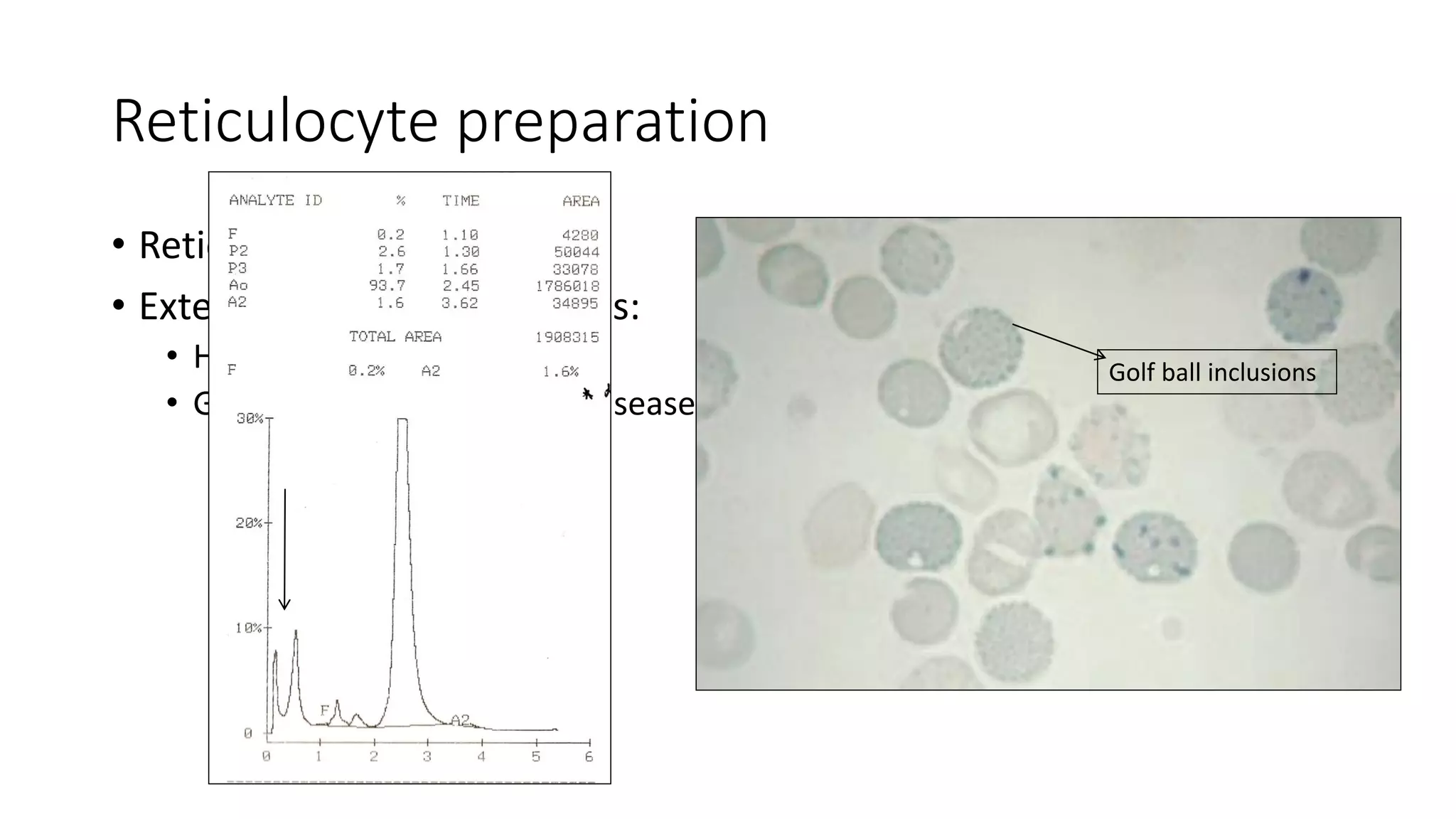 peripheral smear anemea clues.pdf