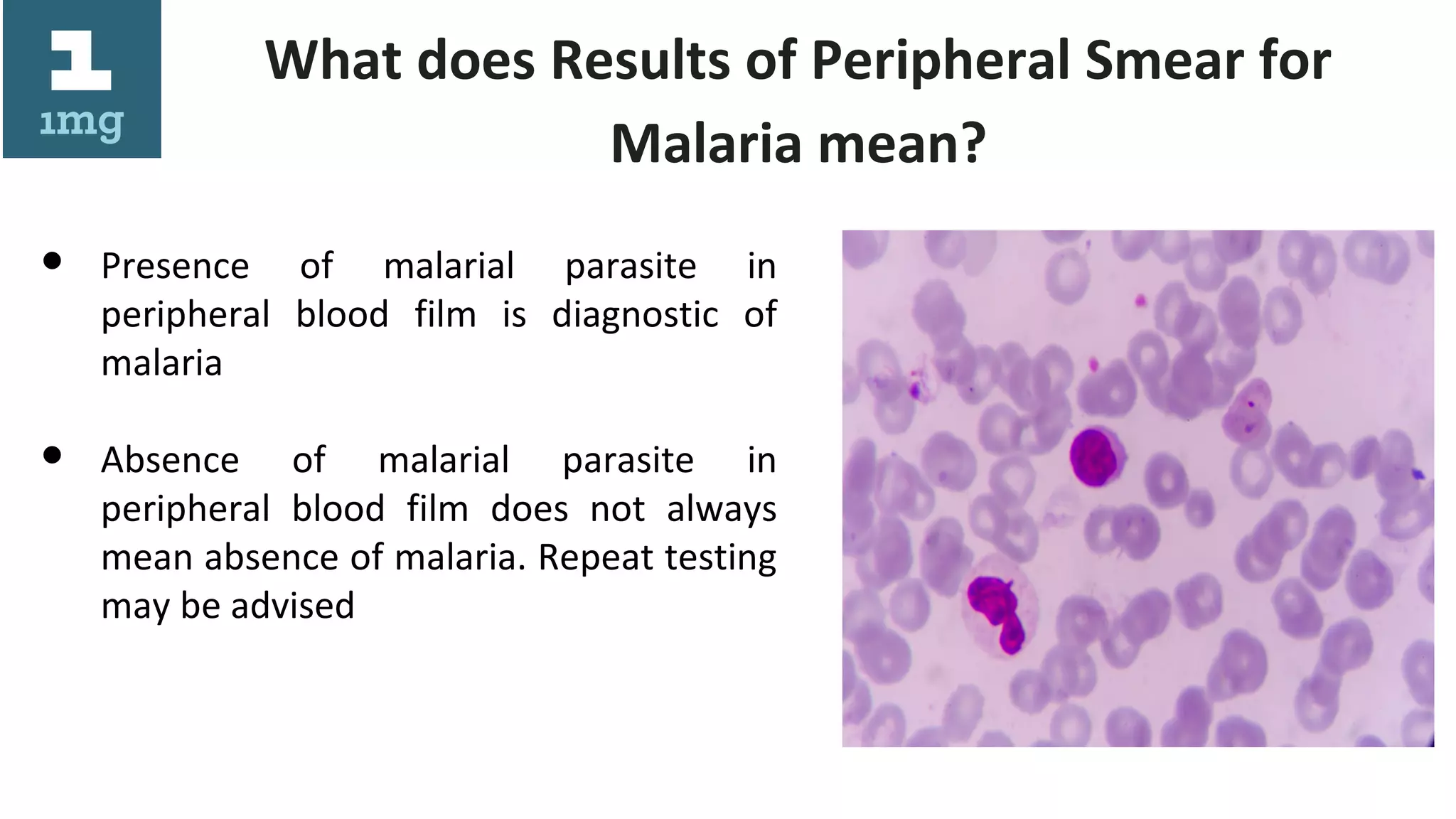 Peripheral smear for malaria | ODP