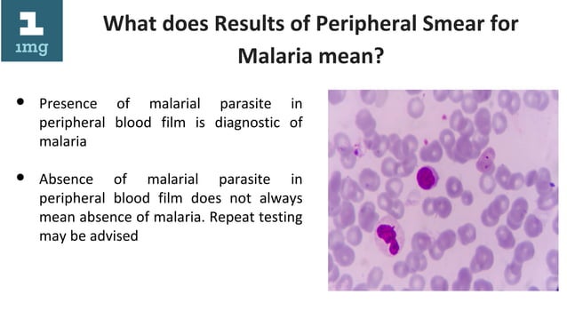 Peripheral smear for malaria | PPT
