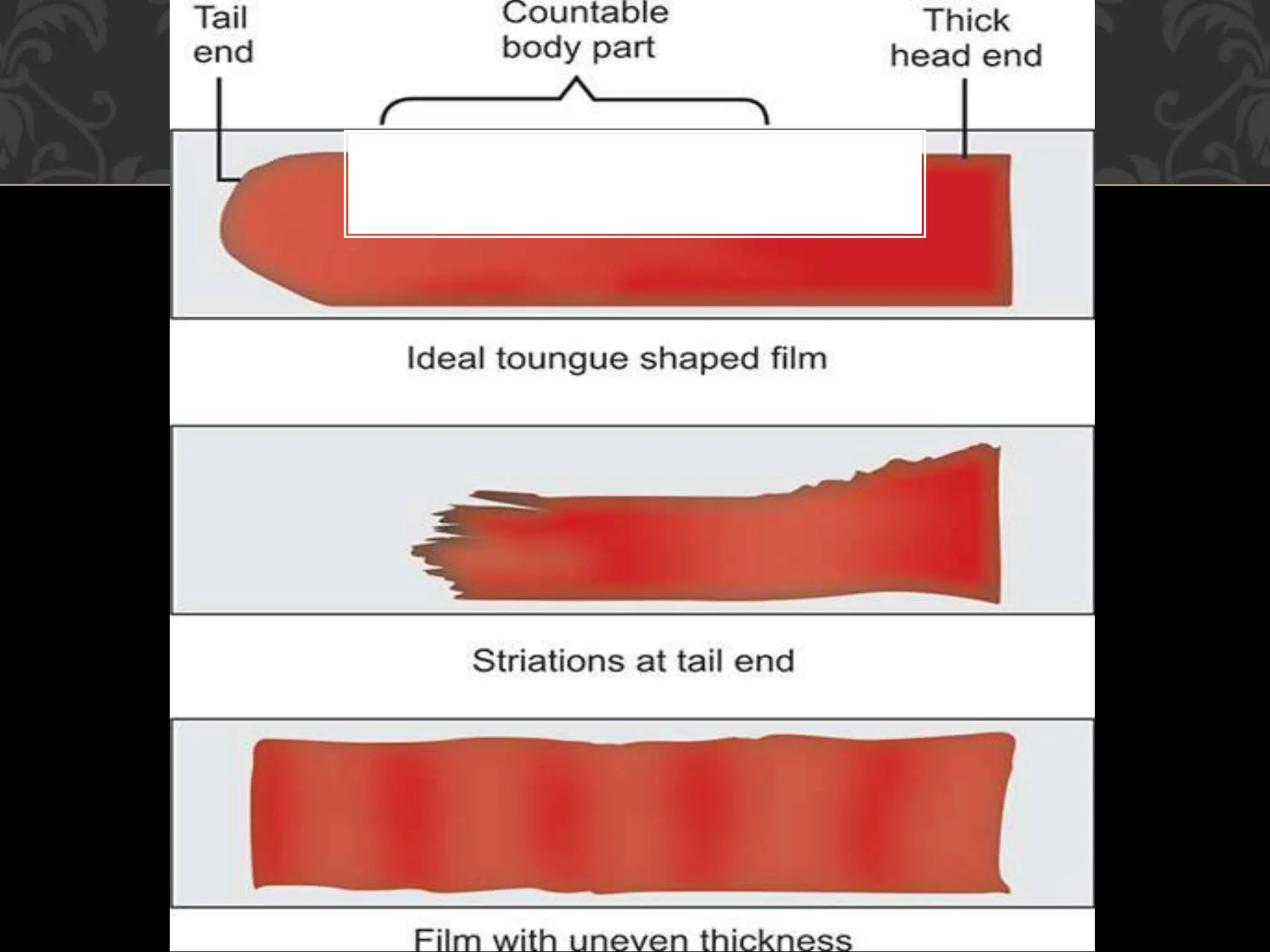 PERIPHERAL SMEAR.pptx
