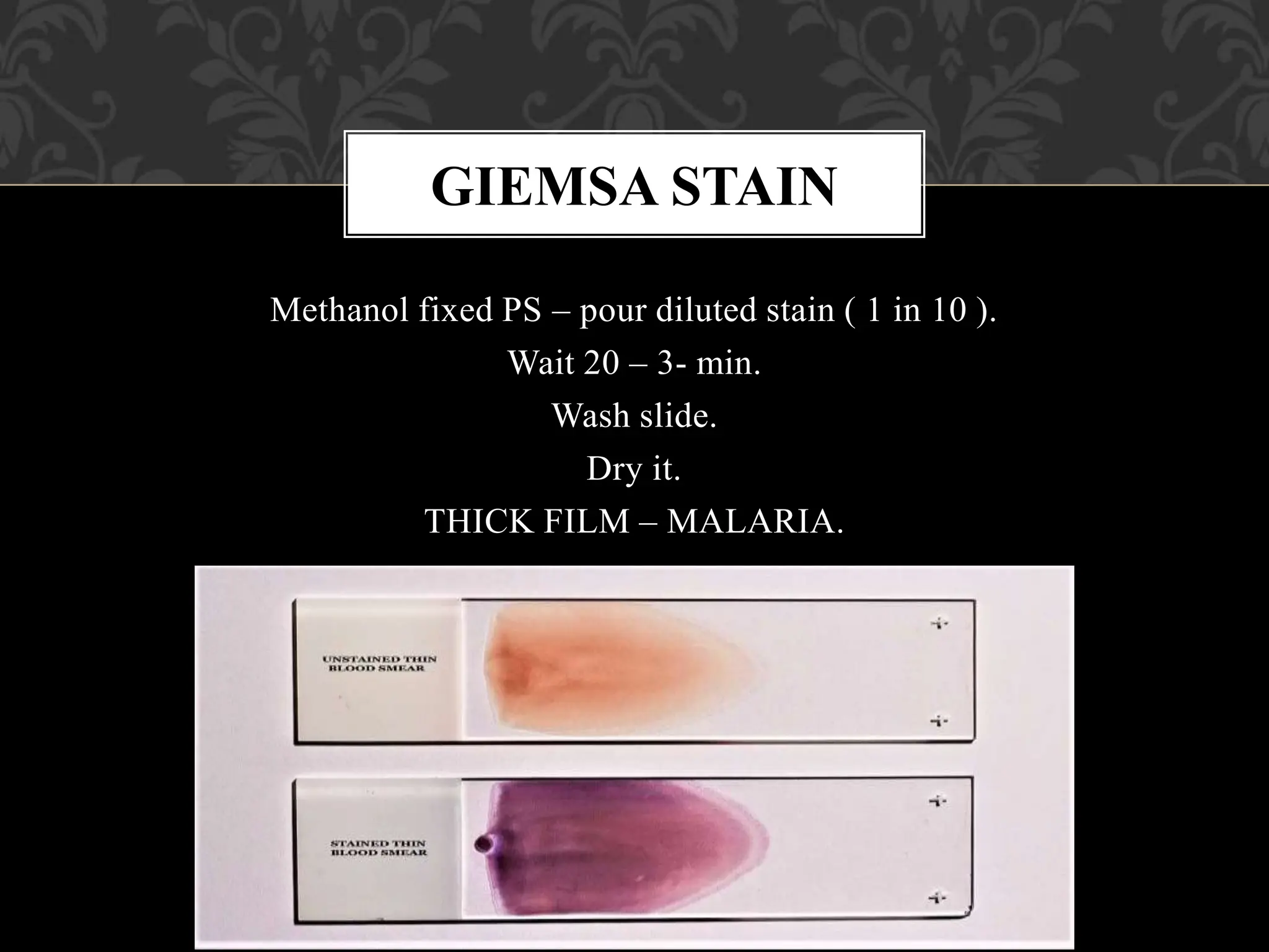 PERIPHERAL SMEAR.pptx