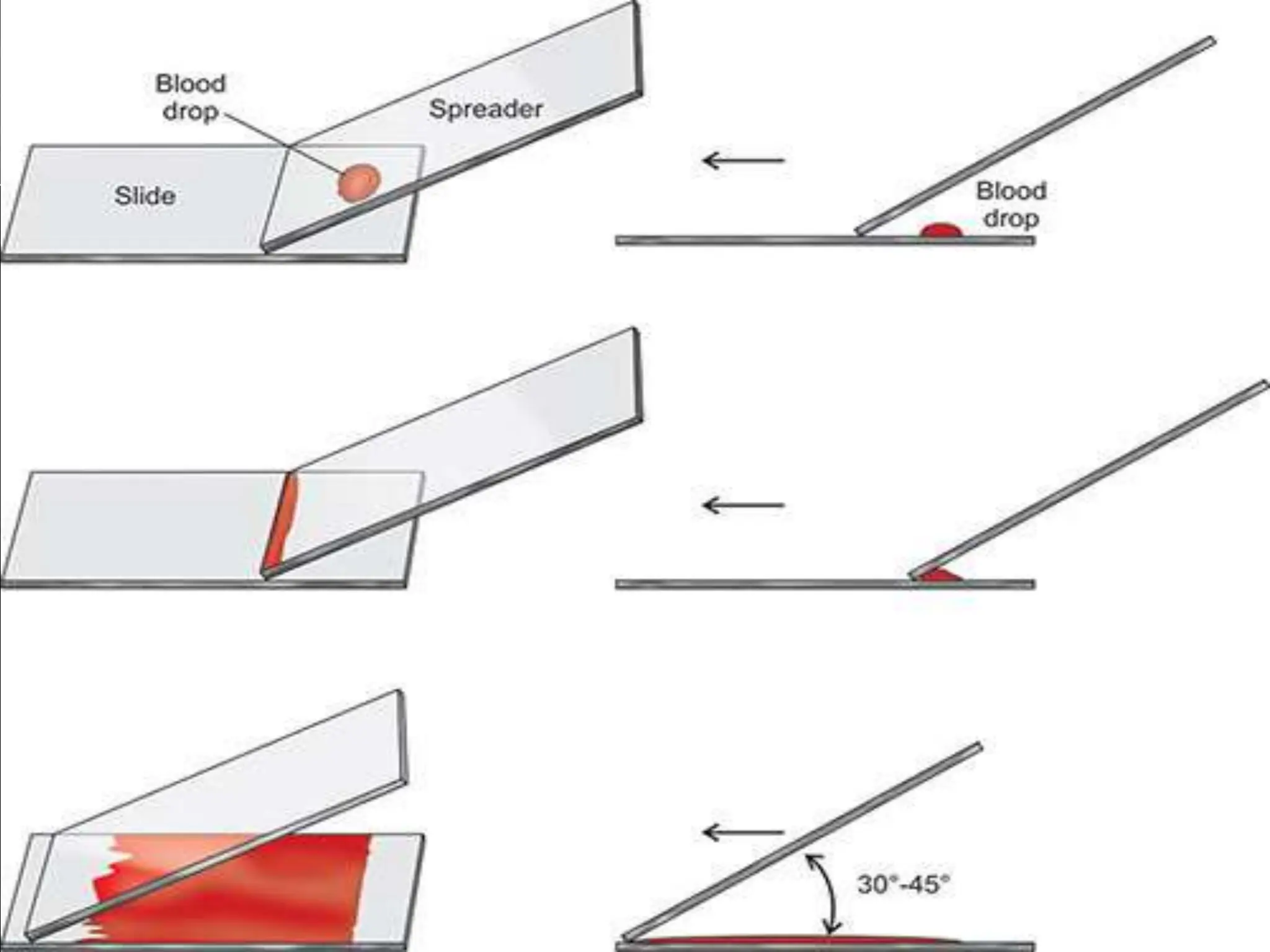 PERIPHERAL SMEAR.pptx