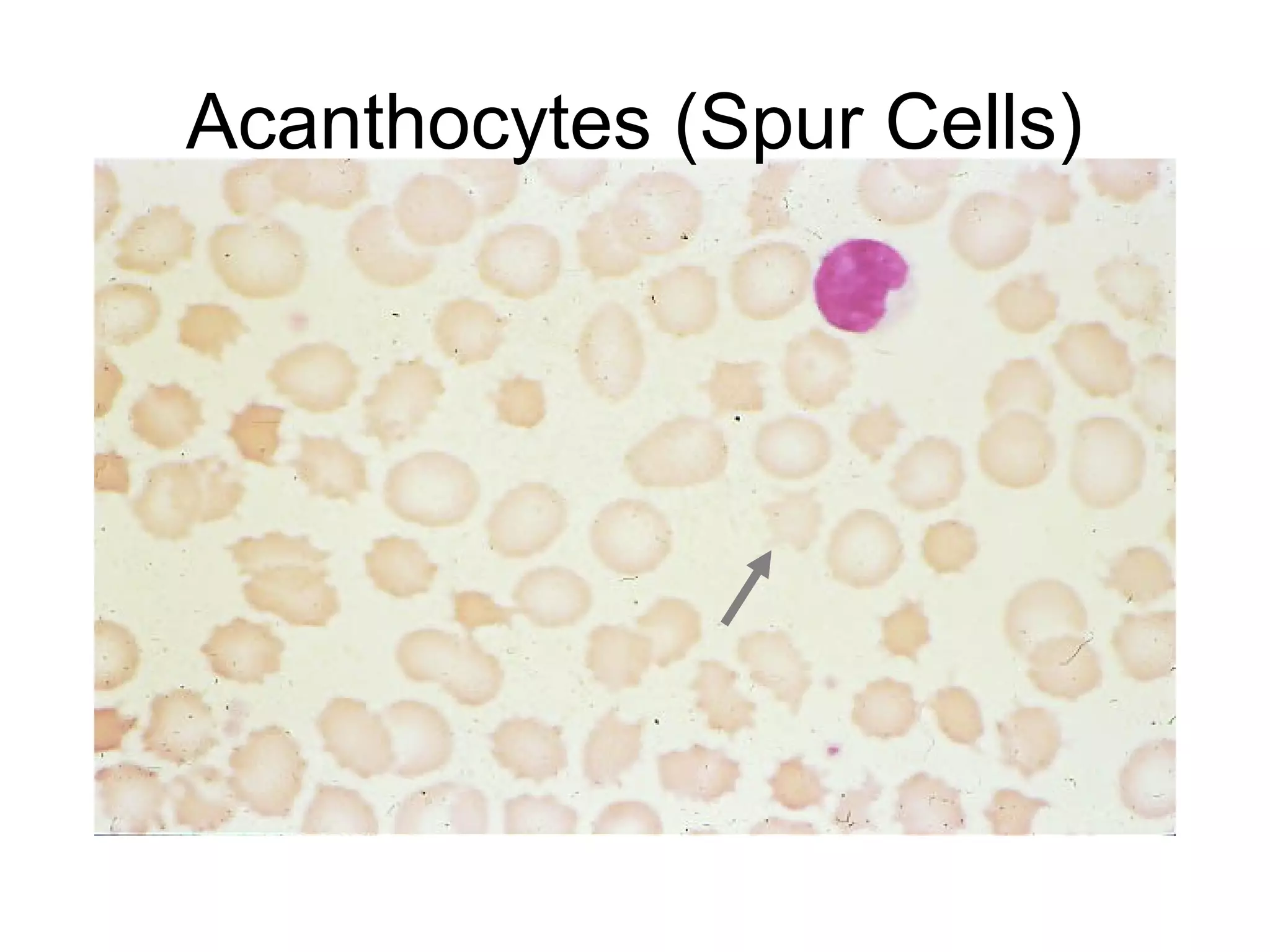 Peripheral smear | PPT