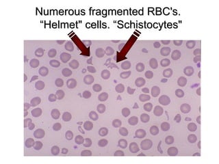Helmet Cells