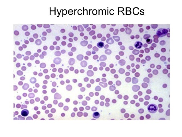 Peripheral smear