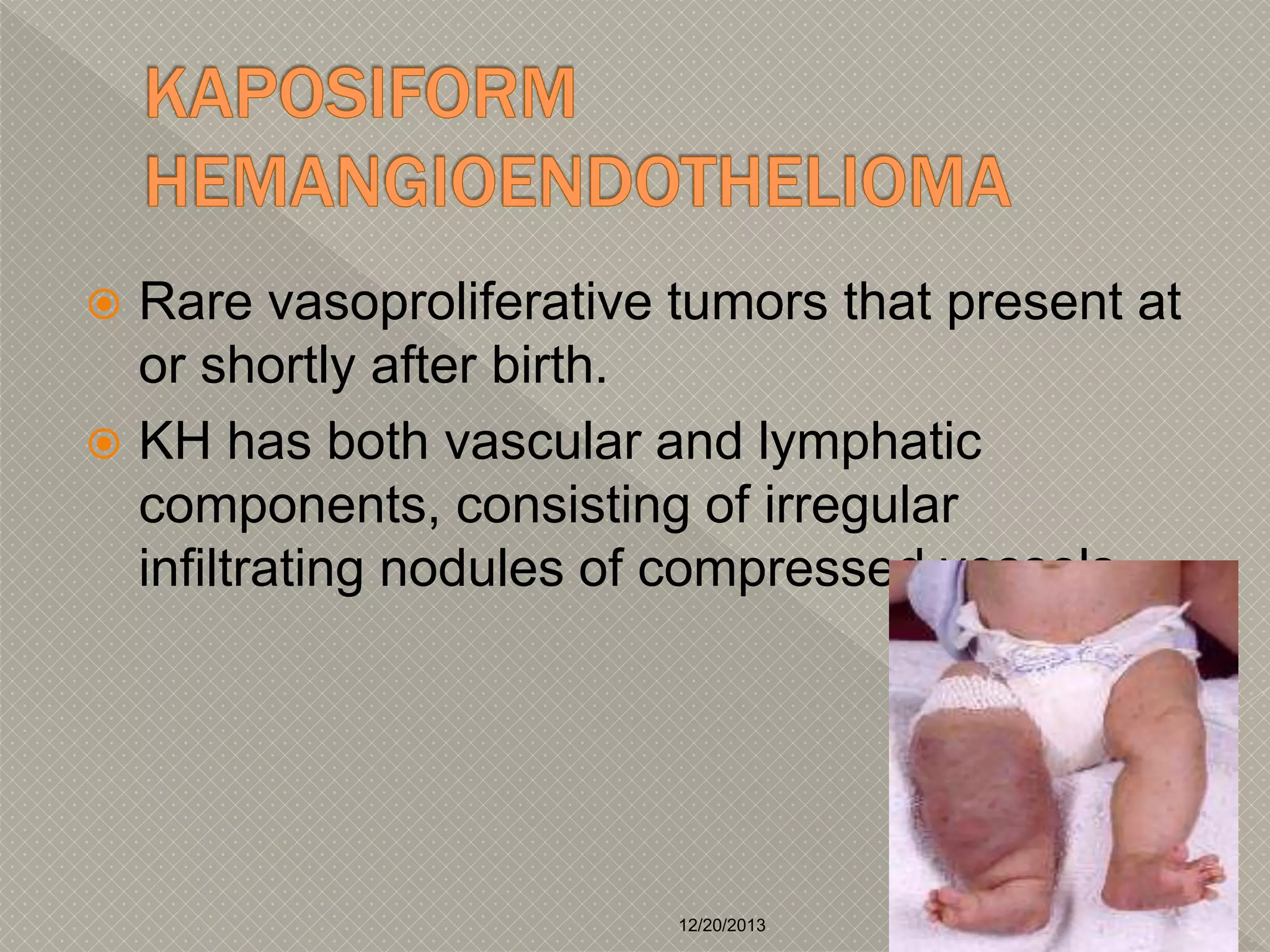 Peripheral vascular anomalies | PPT