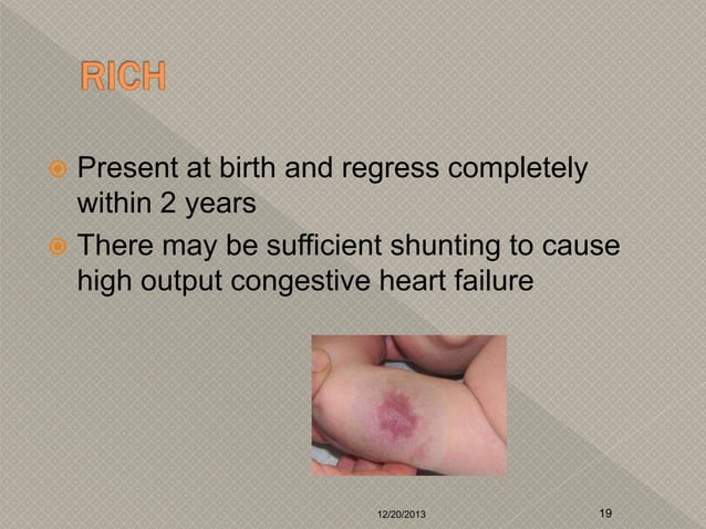 Peripheral vascular anomalies | PPT