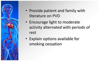 Peripheral vascular disease | PPTX