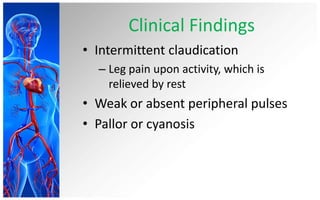 Peripheral vascular disease | PPTX