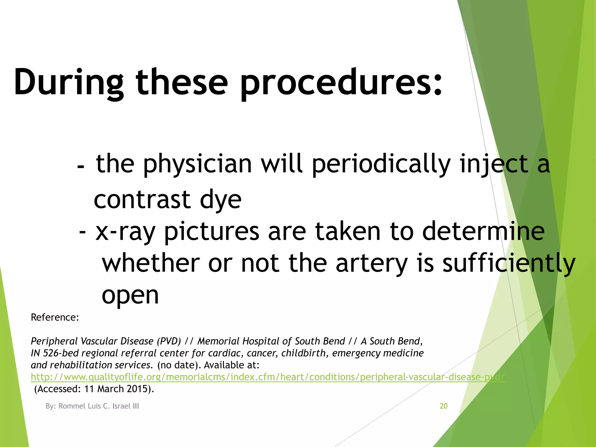 Peripheral Vascular Disease | PPTX