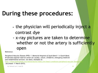 Peripheral Vascular Disease | PPTX
