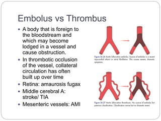 Peripheral vascular disease | PPTX