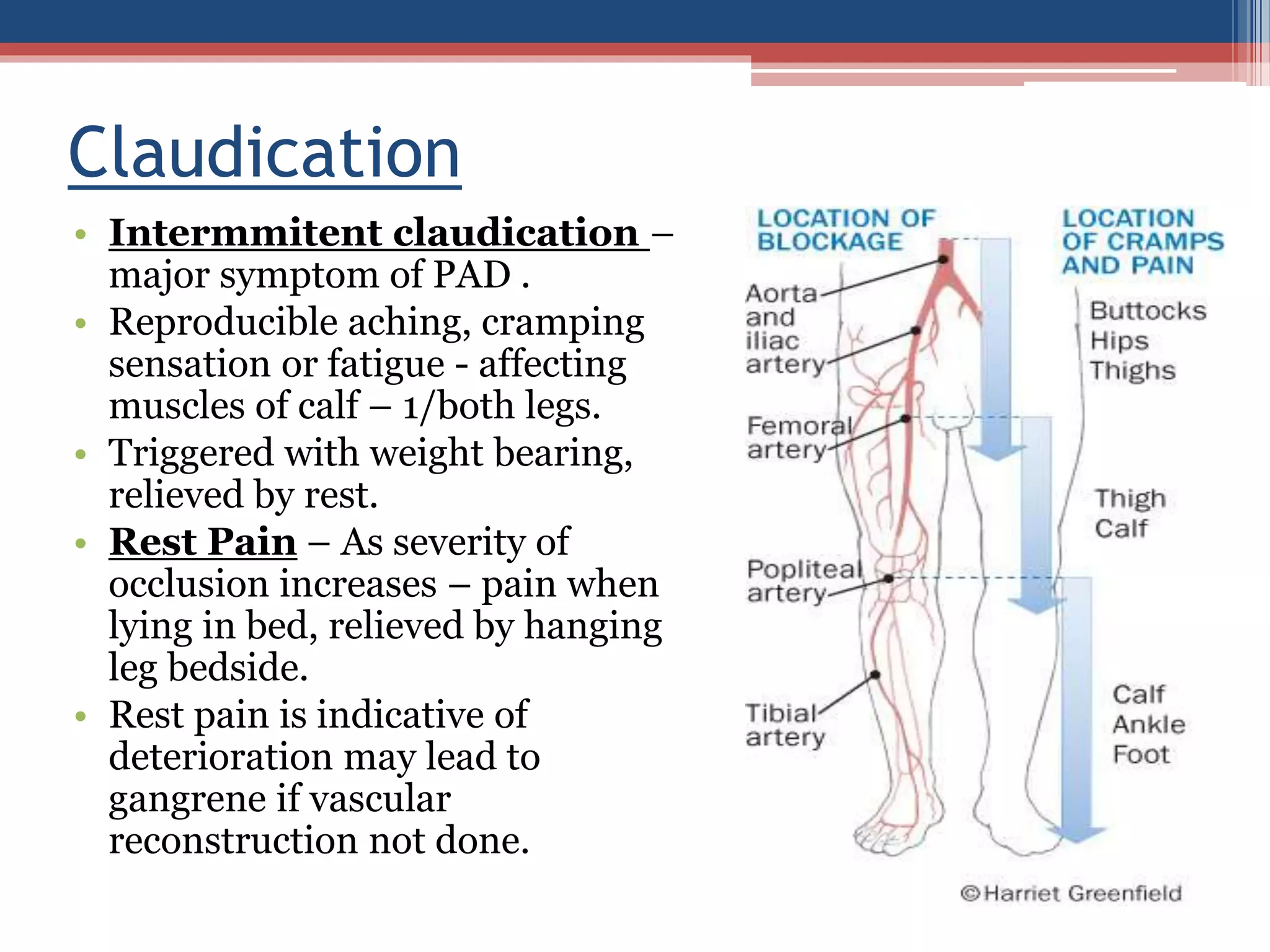 Physiotherapy Management in Peripheral arterial disease | PPTX