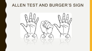 Peripheral vascular disease | PPT