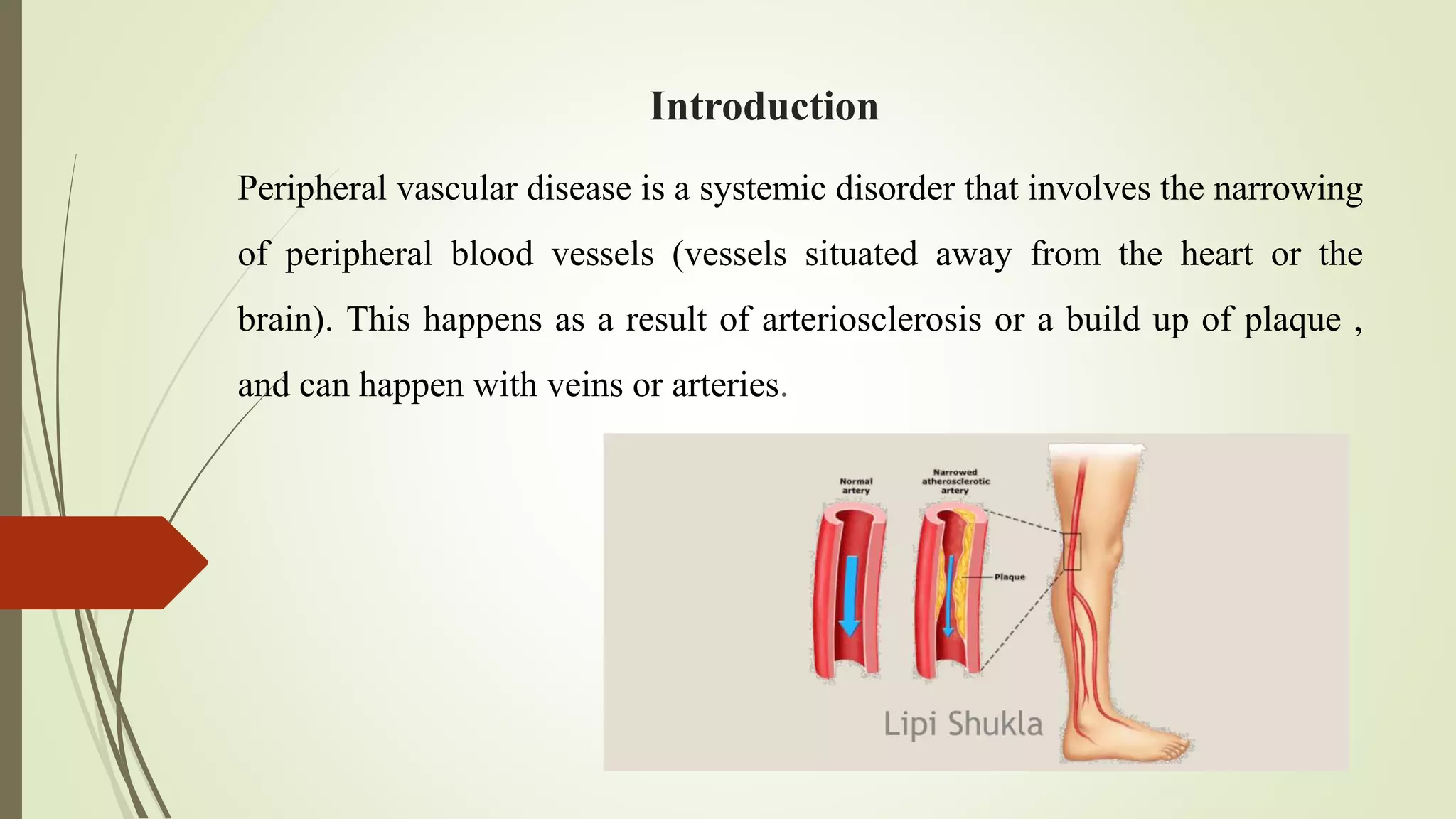 peripheral vascular disease.pptx