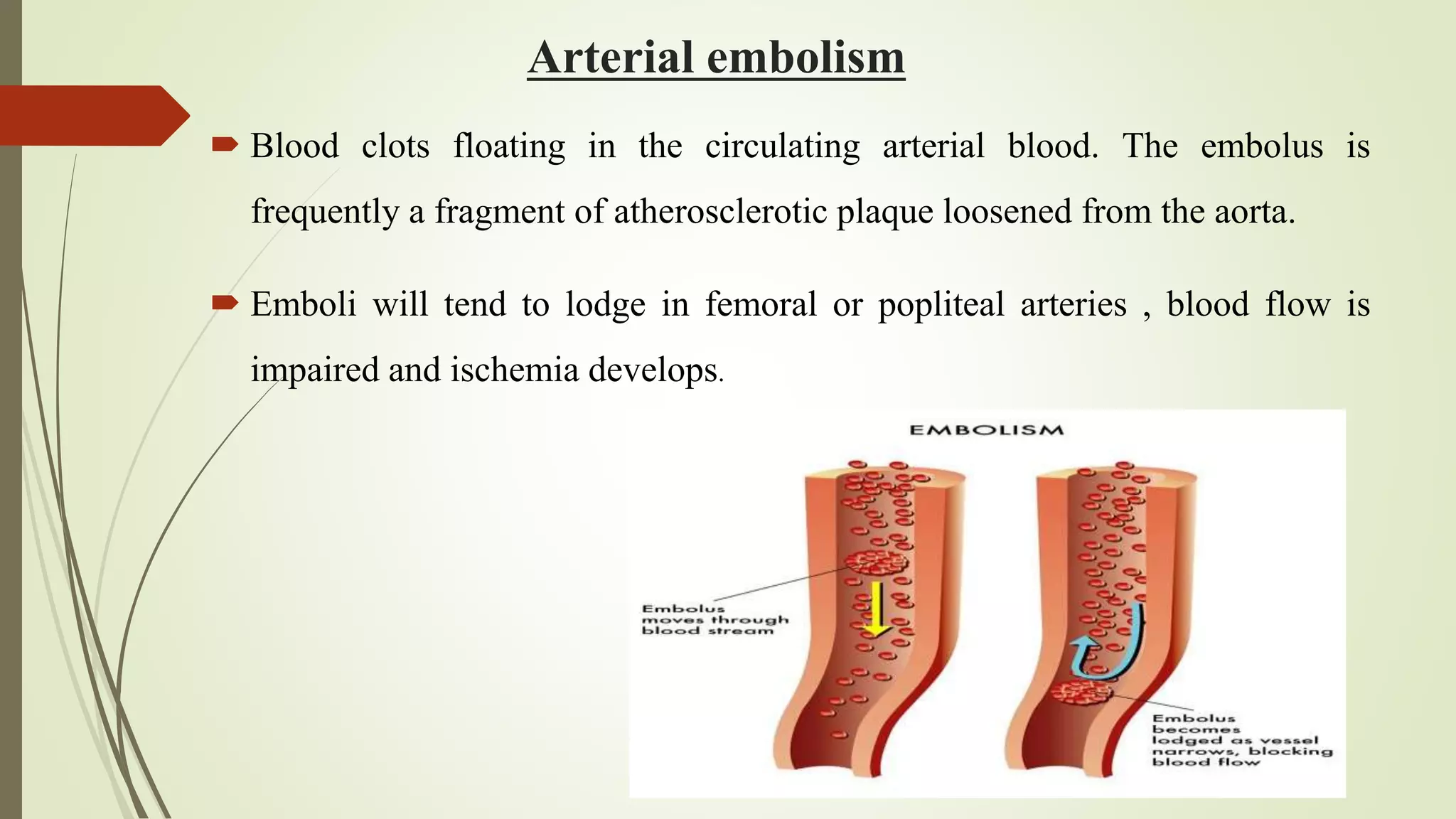 peripheral vascular disease.pptx