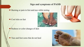 peripheral vascular disease.pptx