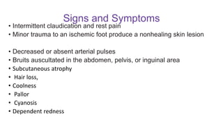 Topic : Peripheral Vascular Disease.pptx
