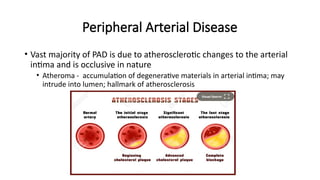 PERIPHERAL VASCULAR DISEASE.pptx peripeh | PPTX