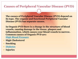 Peripheral vascular disease (pvd) | PPTX
