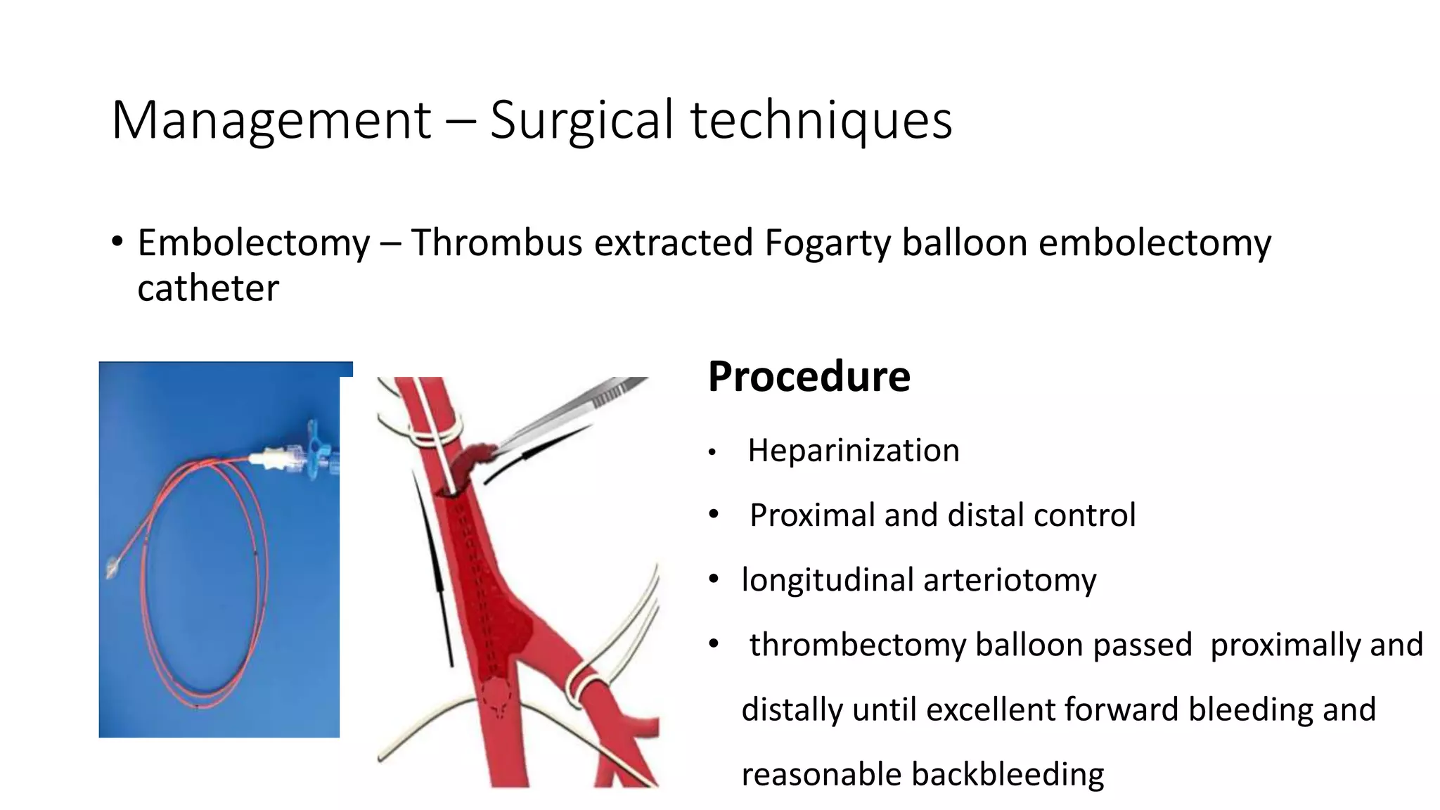 Peripheral vascular diseases | PPTX