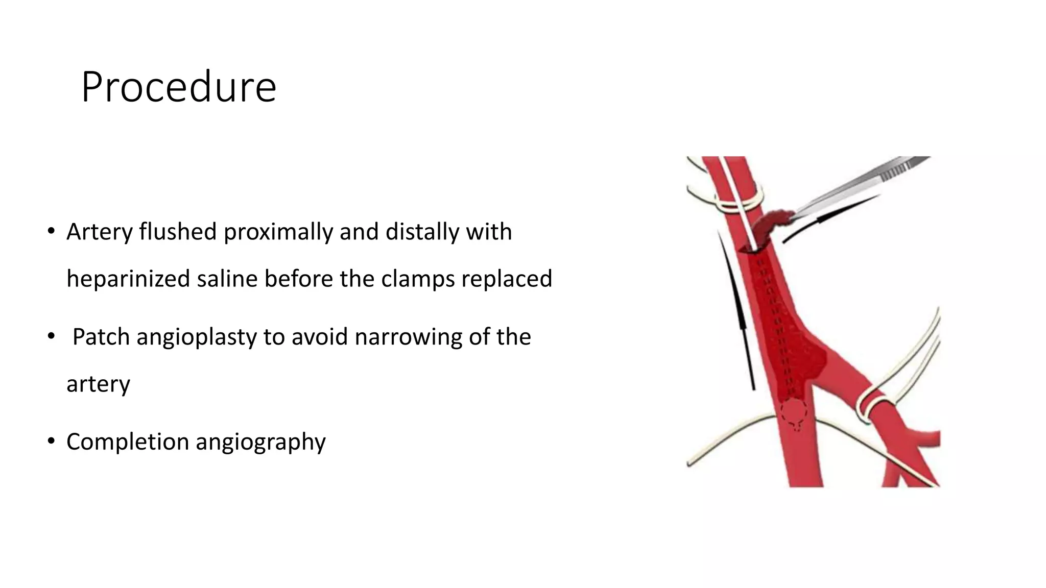 Peripheral vascular diseases | PPTX
