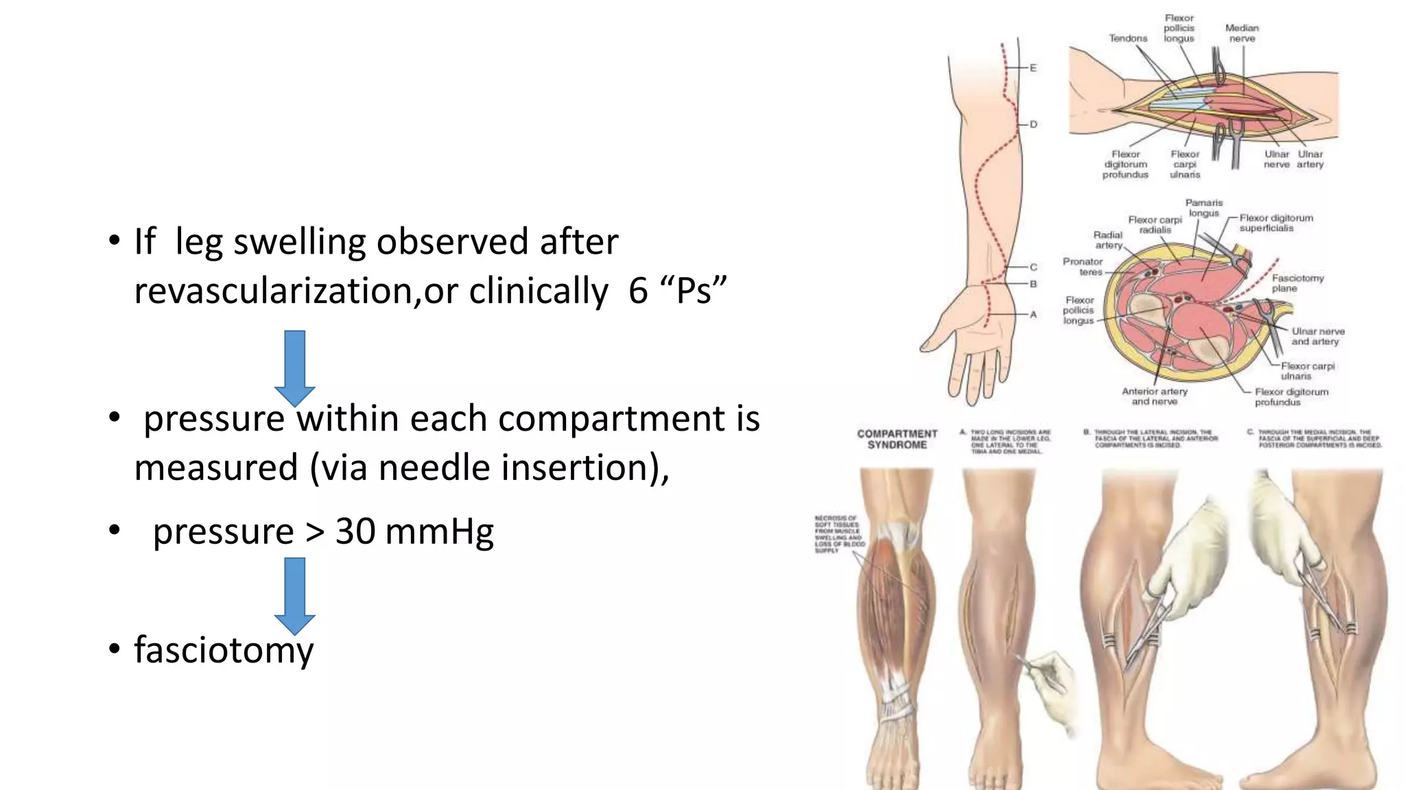 Peripheral vascular diseases | PPTX