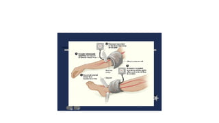 peripheral vascular diseases.pptx. Give basic outline | PPT