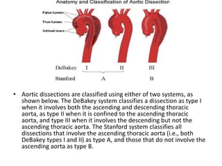 Peripheral vascular disorder | PPT